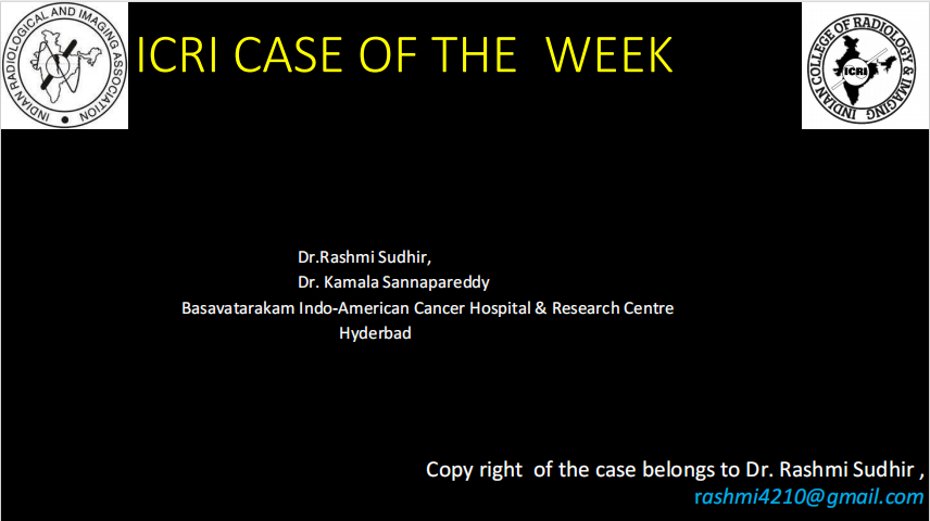 Case of the Week – ICRI